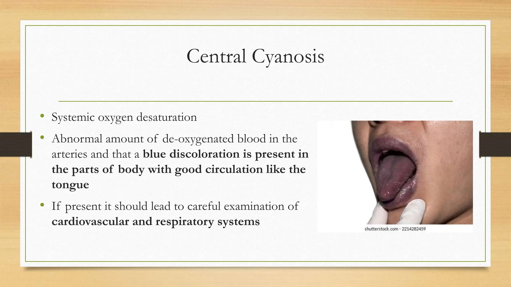 Cyanosis for medical school students.pptx