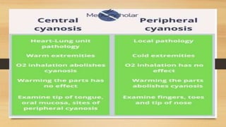 Cyanosis for medical school students.pptx