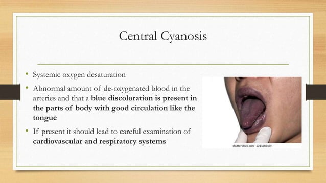 Cyanosis for medical school students.pptx