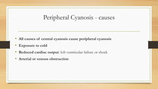 Cyanosis for medical school students.pptx