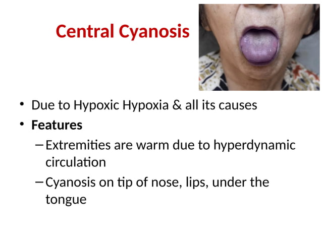 Cyanosis 1st year mbbs by amruthesh.pptx