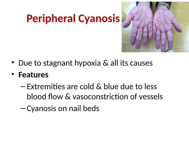 Cyanosis 1st year mbbs by amruthesh.pptx