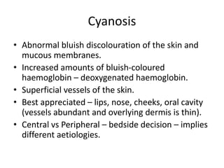cyanosis_1.pptx