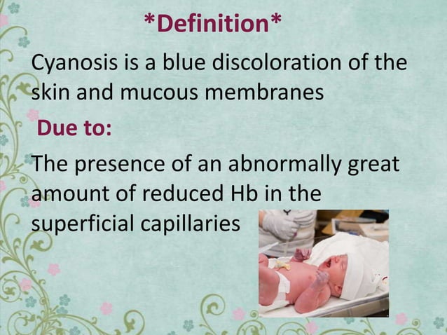 Cyanosis | PPTX