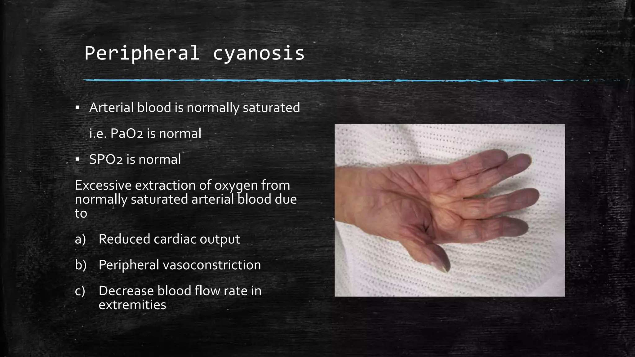 Cyanosis & nail abnormalities | PPTX