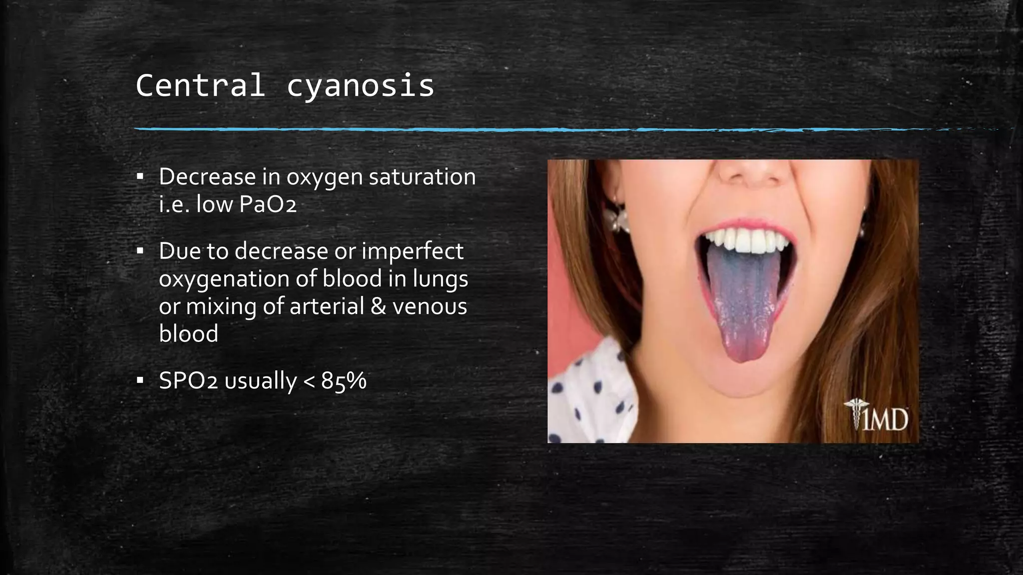 Cyanosis & nail abnormalities | PPTX