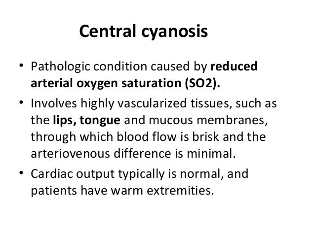 Cyanosis Ppt By Dr Girish Jain