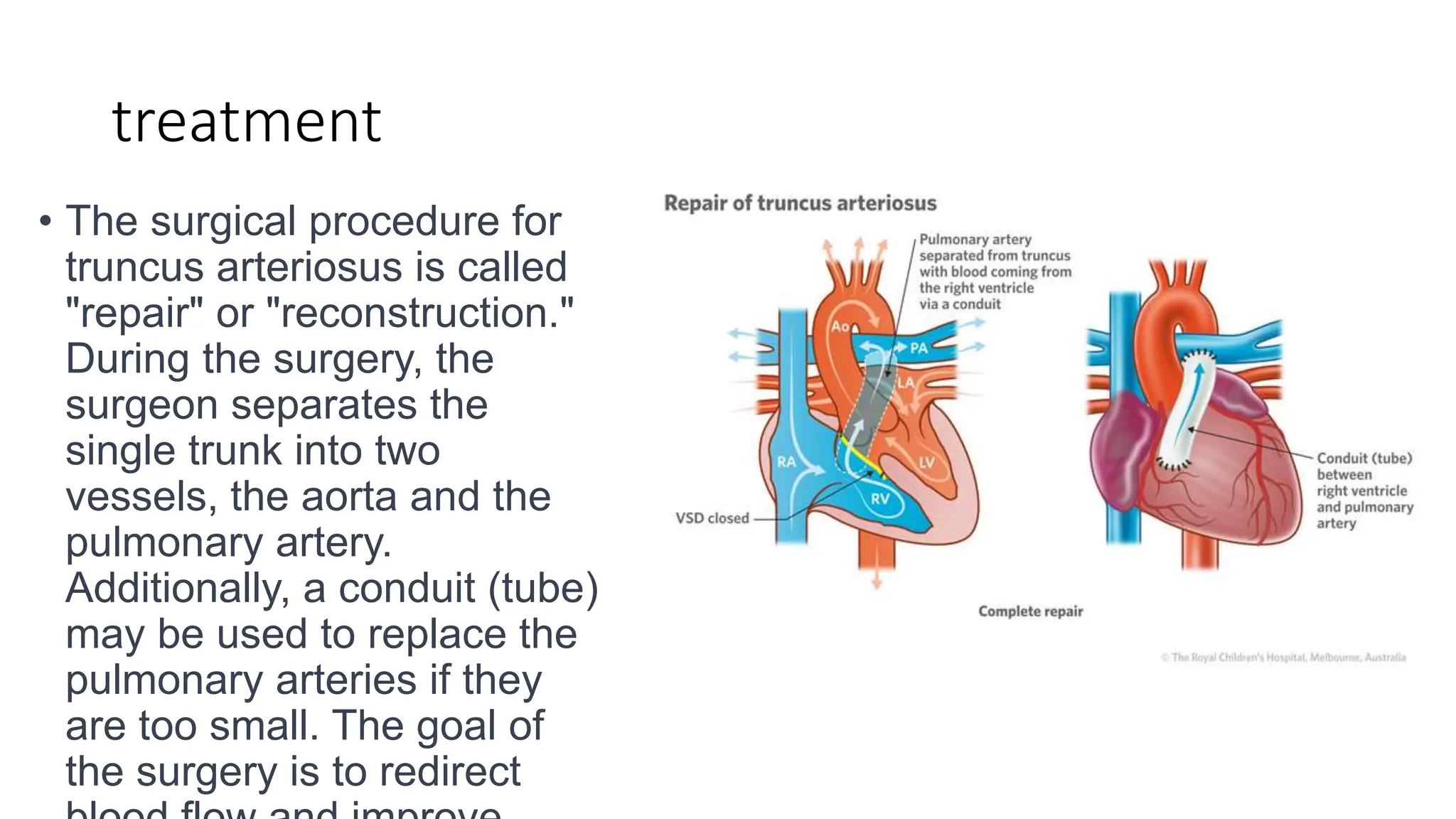 cyanotic congenital heart defects.pptx