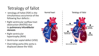 cyanotic congenital heart defects.pptx