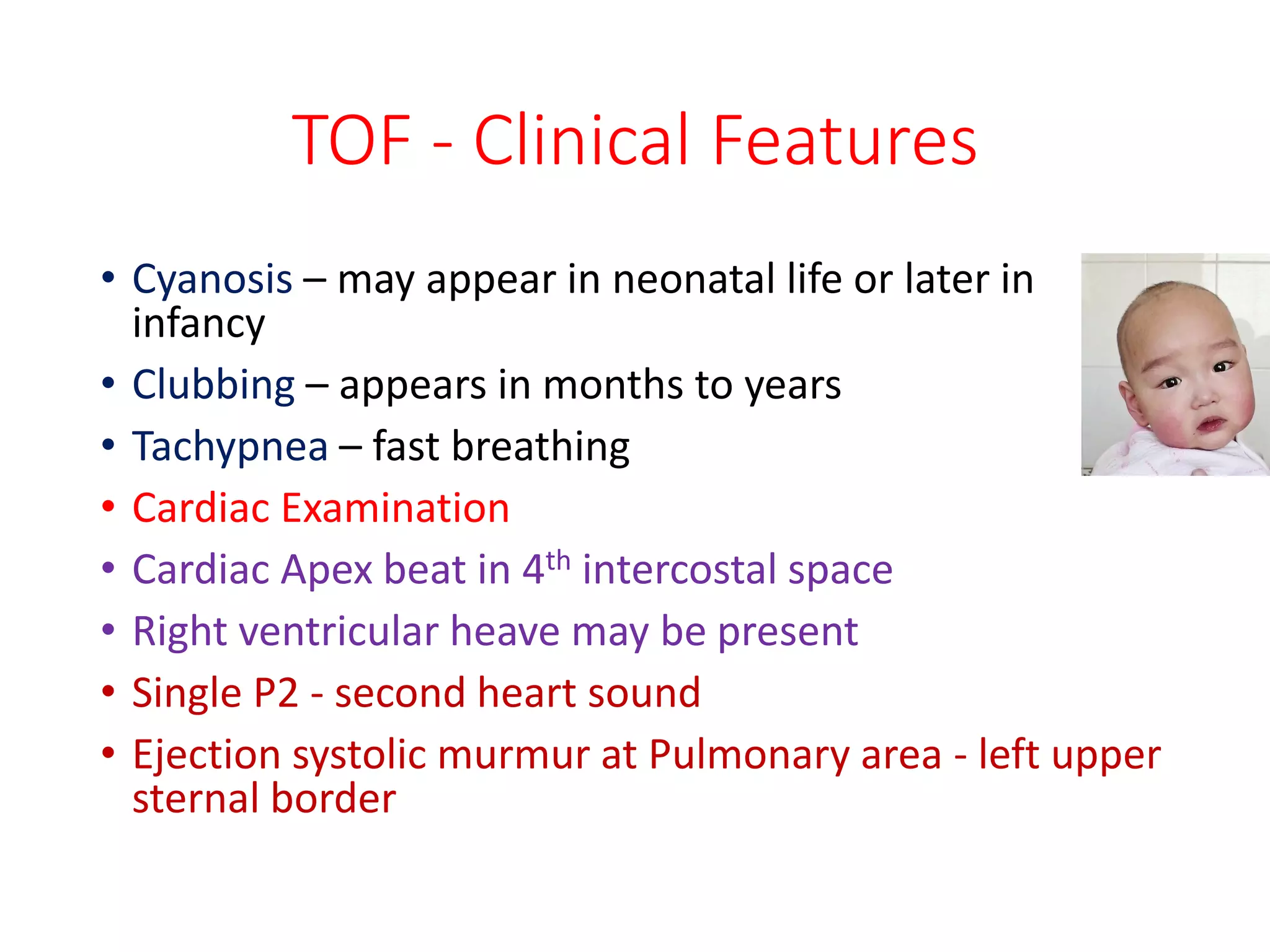 Cyanotic congenital heart disease 2021 | PDF