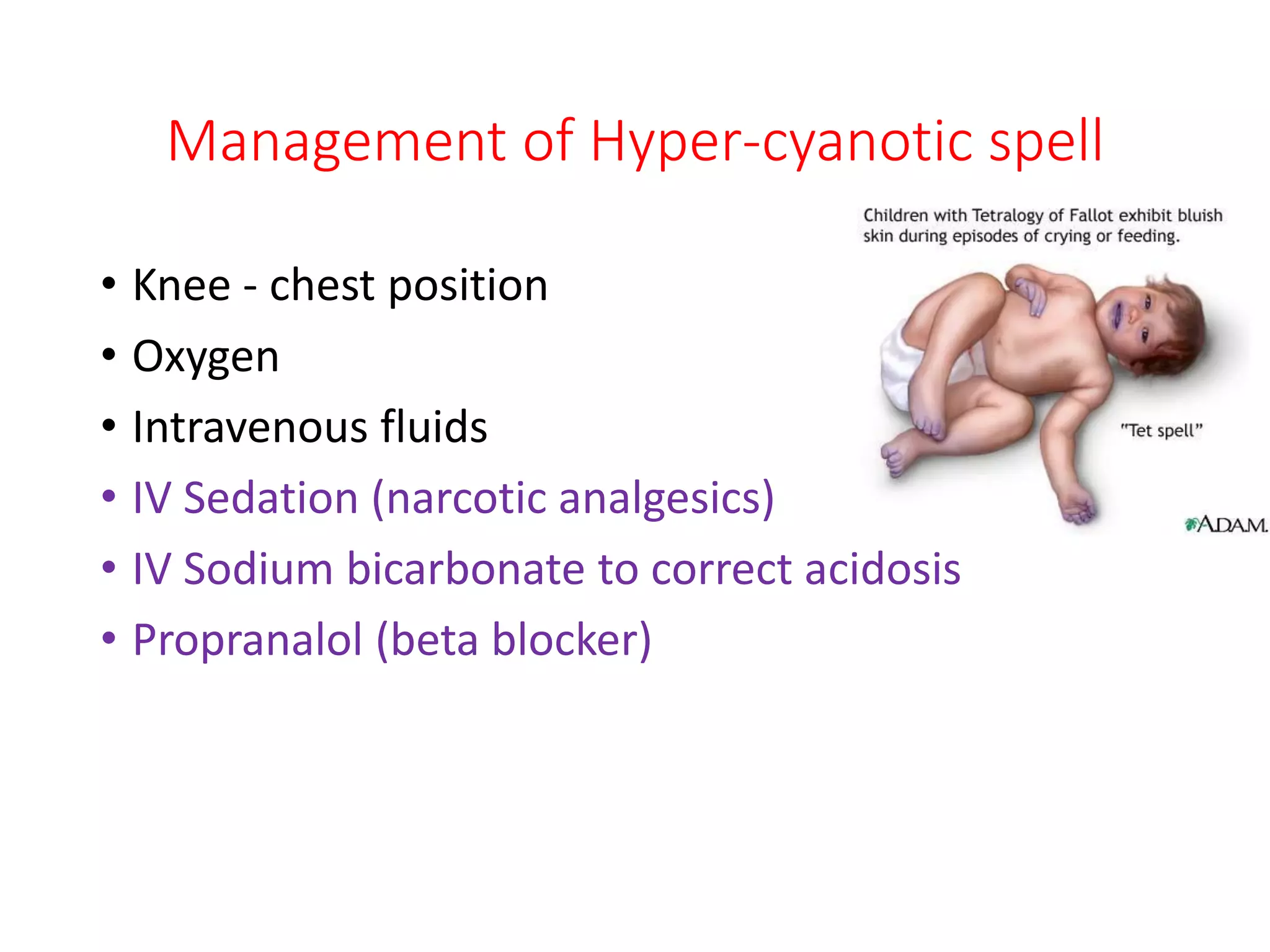 Cyanotic congenital heart disease 2021 | PDF