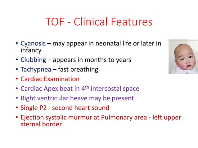 Cyanotic congenital heart disease 2021 | PDF