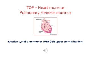 Cyanotic congenital heart disease 2021 | PDF