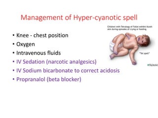 Cyanotic congenital heart disease 2021 | PDF
