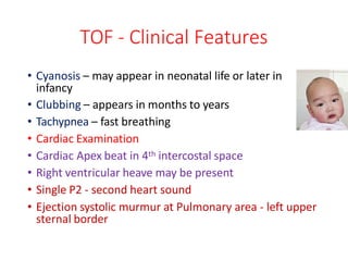 cyanoticcongenitalheartdisease2021-210214173958 (1).pptx