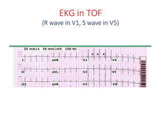 cyanoticcongenitalheartdisease2021-210214173958 (1).pptx