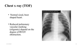 Cyanotic Congenital Heart Diseases-C1.pptx