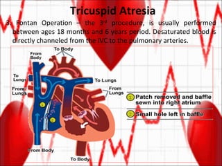 Cyanotic Heart Defects | PPT