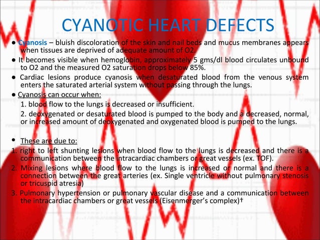 Cyanotic Heart Defects | PPT | Heart and Cardiovascular Diseases ...