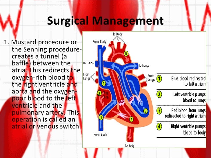 Cyanotic Heart Defects