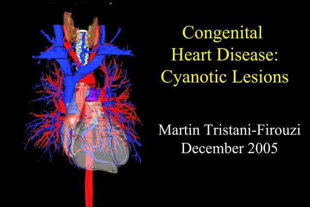 Cyanotic Heart Disease | PPT | Heart and Cardiovascular Diseases ...