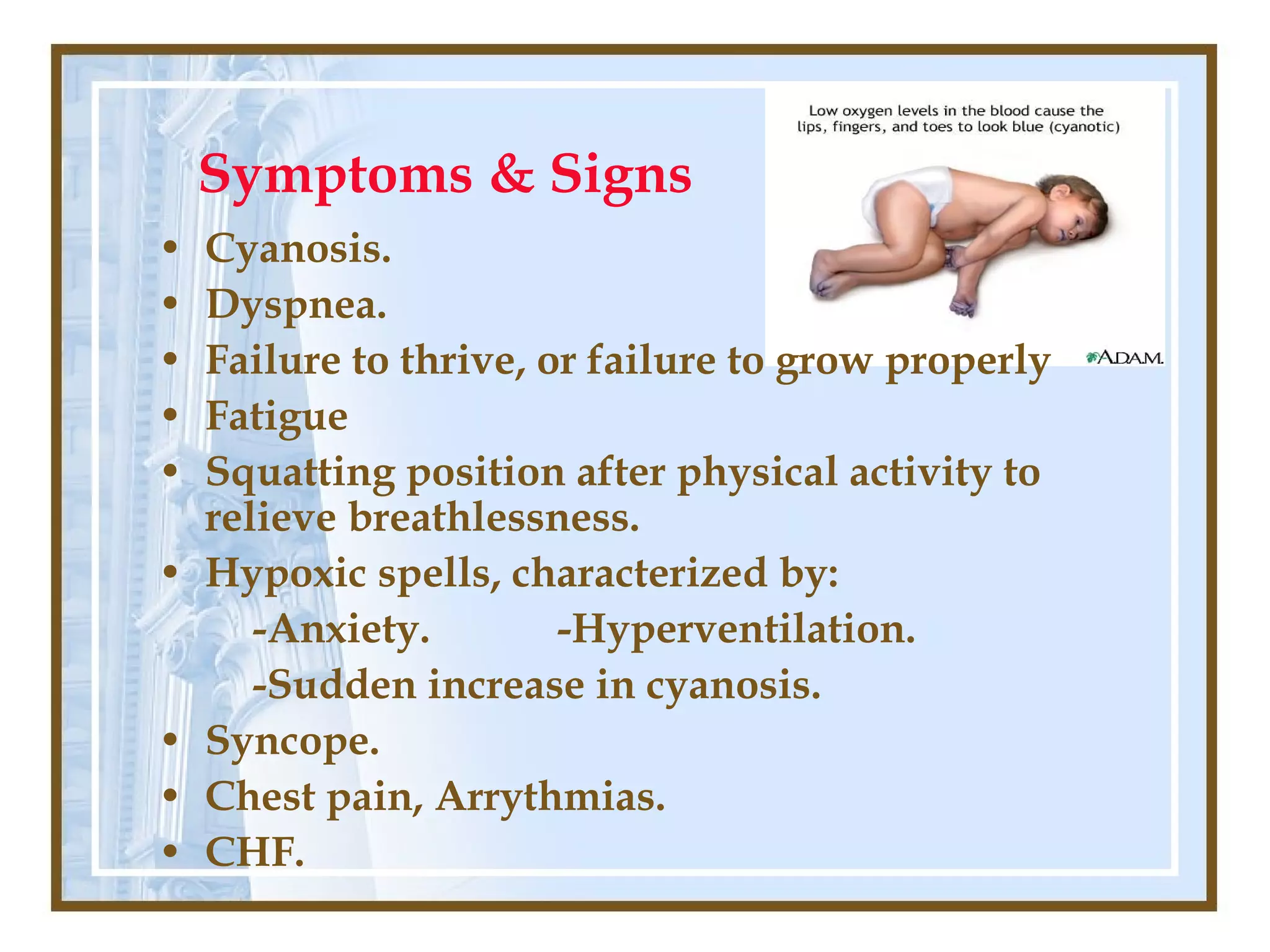 Cyanotic heart disease | PPS