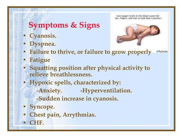 Cyanotic heart disease | PPS | Heart and Cardiovascular Diseases ...