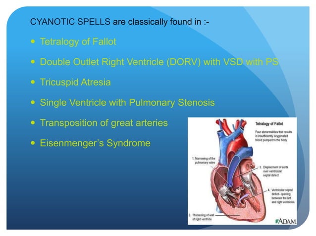 Cyanotic Spells | PPTX | Lung and Respiratory Health | Diseases and ...