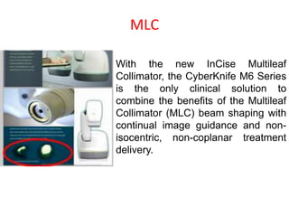 Cyberknife | PPT