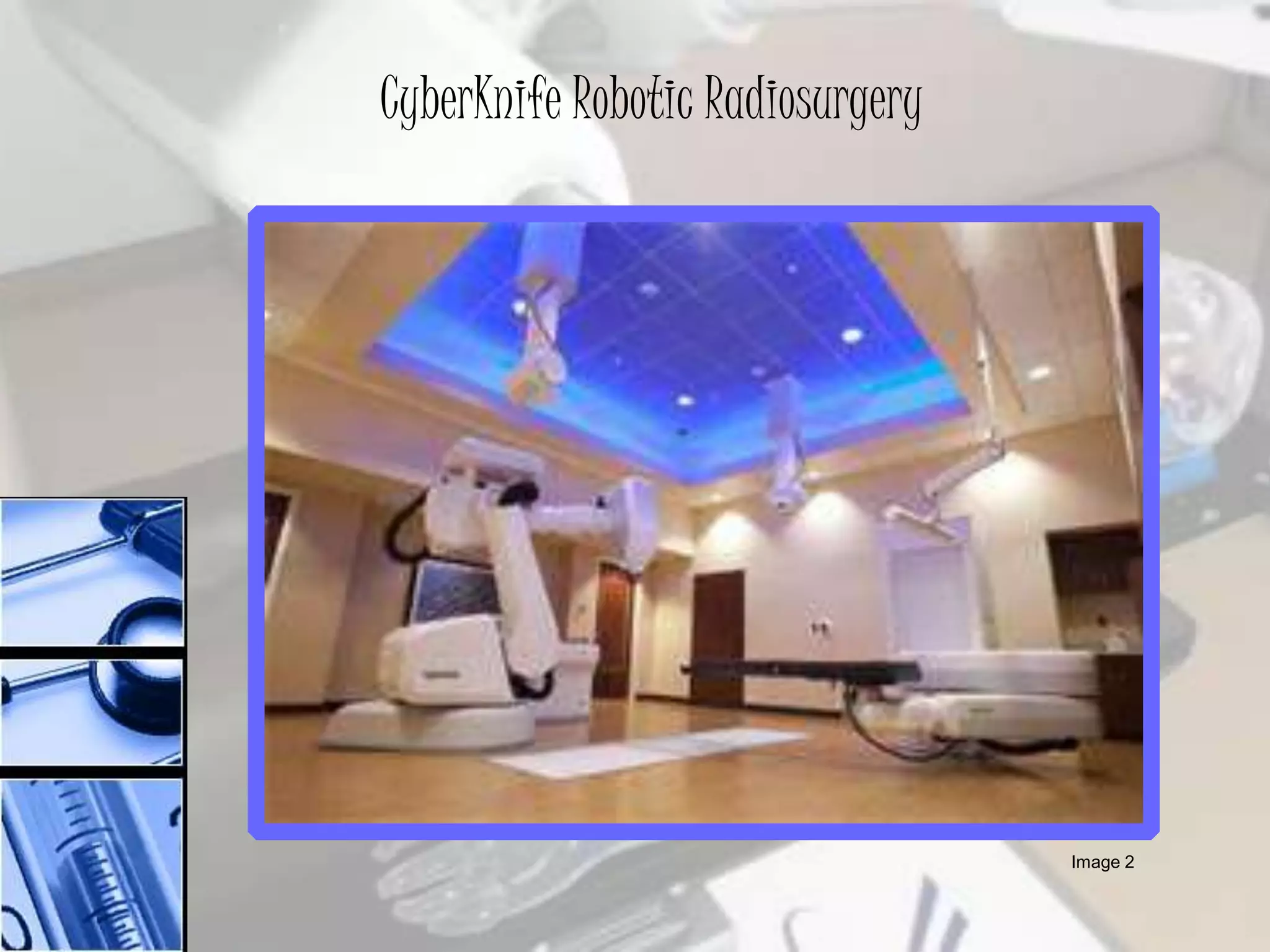 Cyber knife robotic radiosurgery system | PPTX