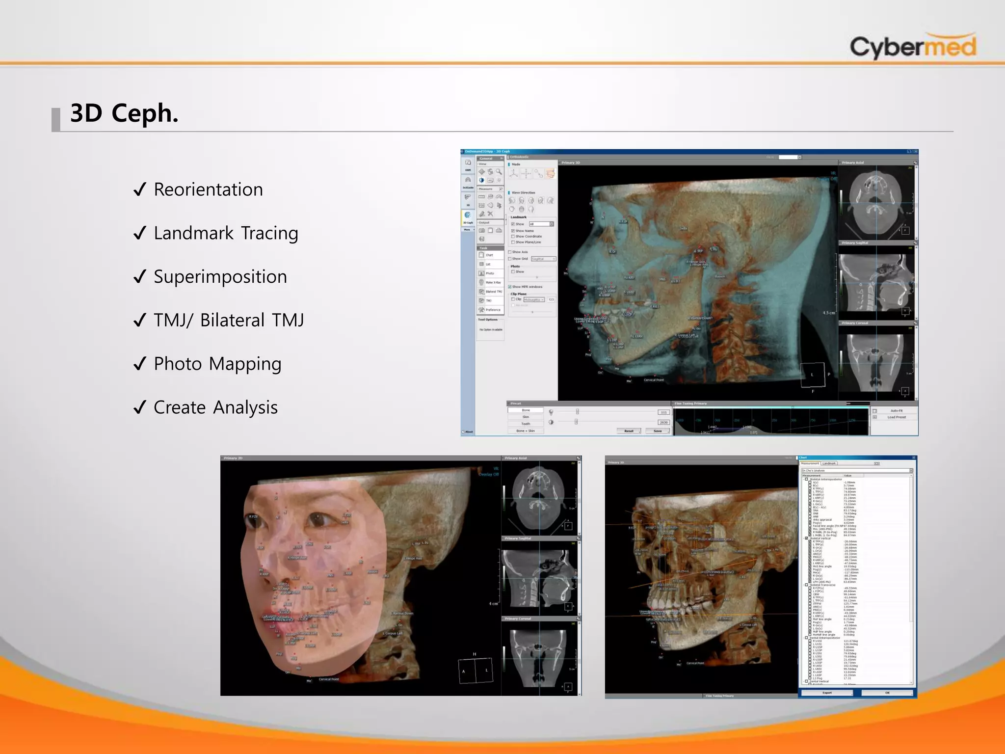 Cybermed OnDemand3D Dental Imaging software | PDF