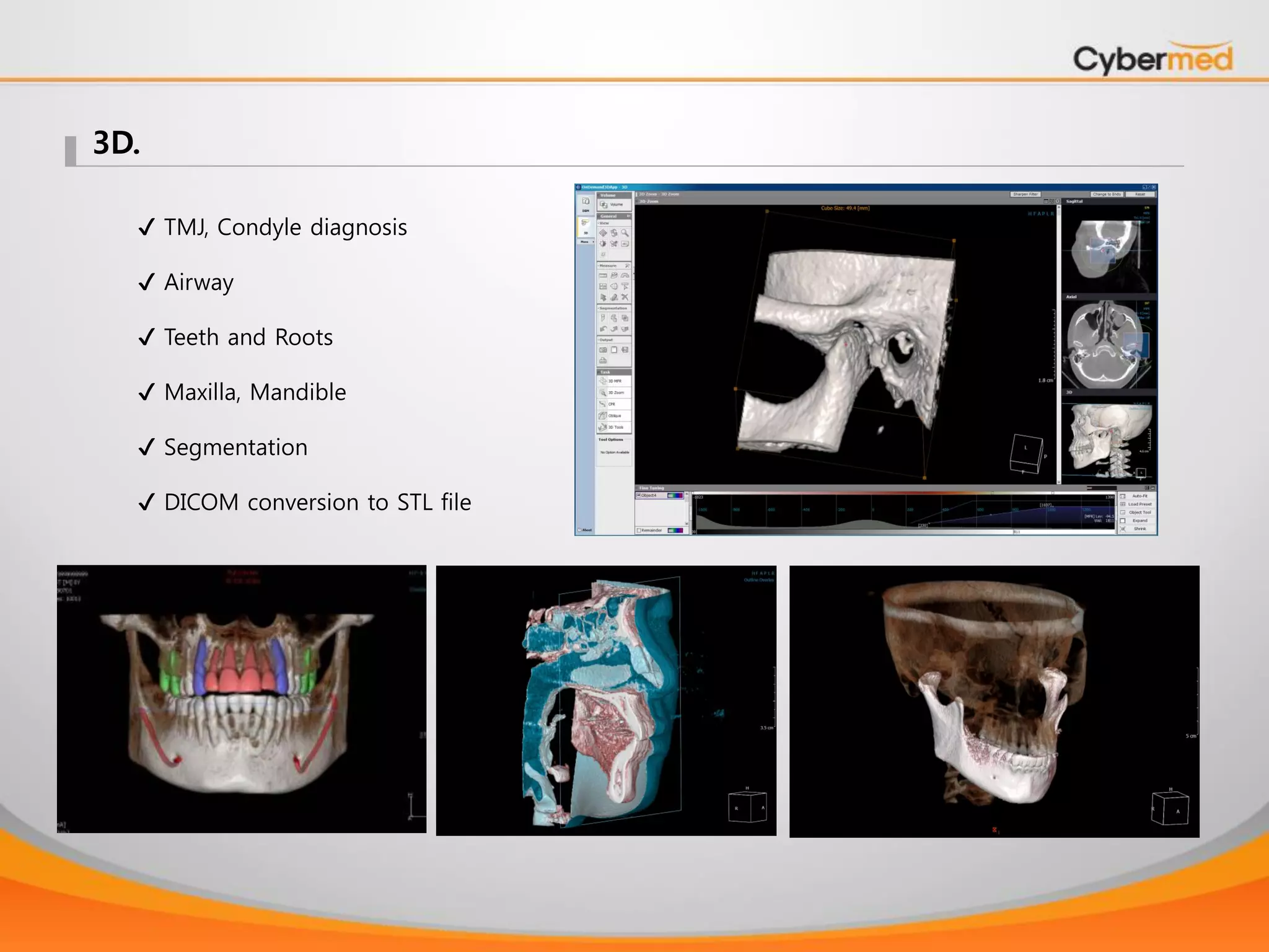 Cybermed OnDemand3D Dental Imaging software | PDF