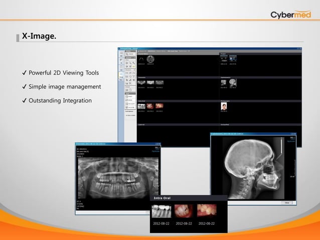 Cybermed OnDemand3D Dental Imaging software | PDF