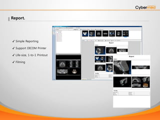 Cybermed OnDemand3D Dental Imaging software | PDF
