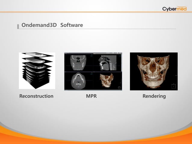 Cybermed OnDemand3D Dental Imaging software | PDF