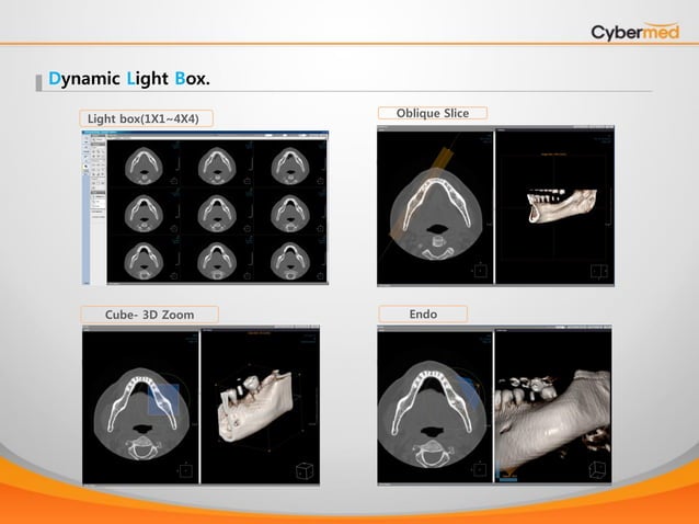 Cybermed OnDemand3D Dental Imaging software | PDF