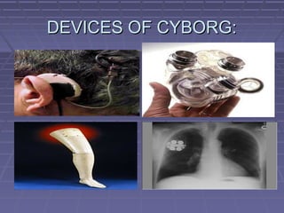 Cyborg | PPT | Heart and Cardiovascular Diseases | Diseases and Conditions