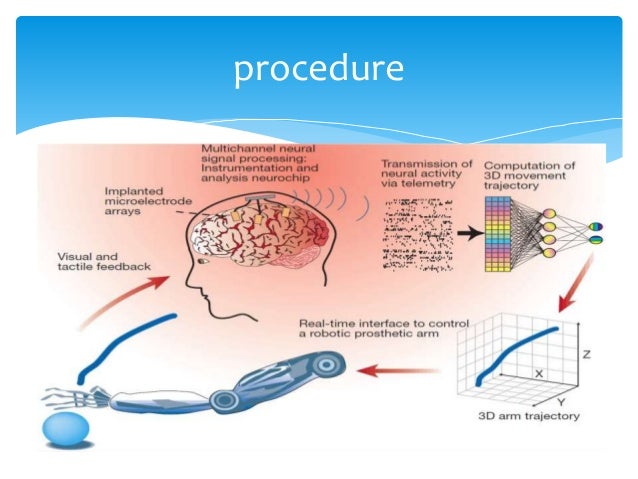 DARPA and World PREPARES FOR CYBORG FUTURE USING NEURAL INTERFACE IM…
