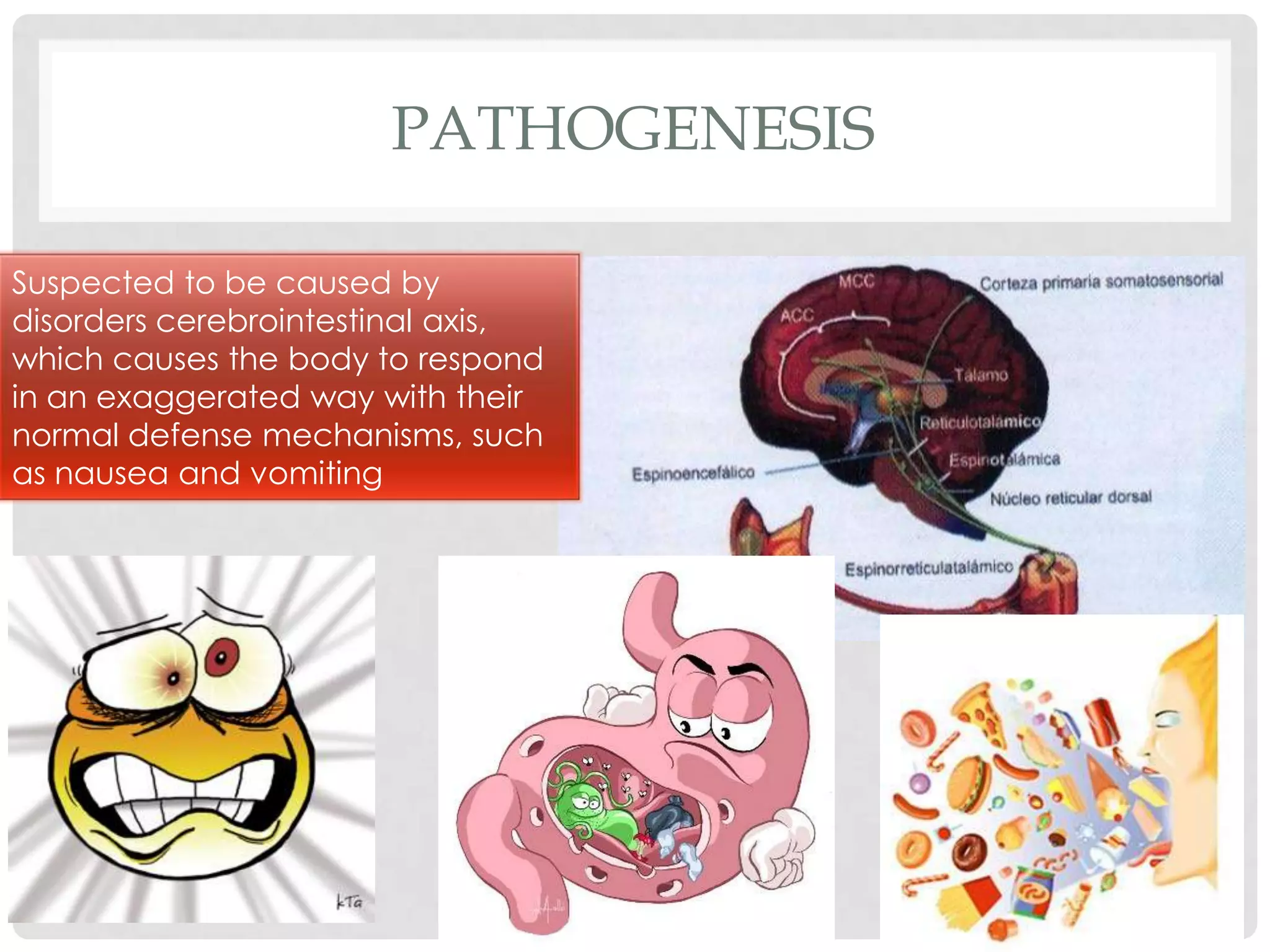 Cycle vomitus syndrome (cvs) | PPTX