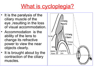 Cyclorefraction | PPT
