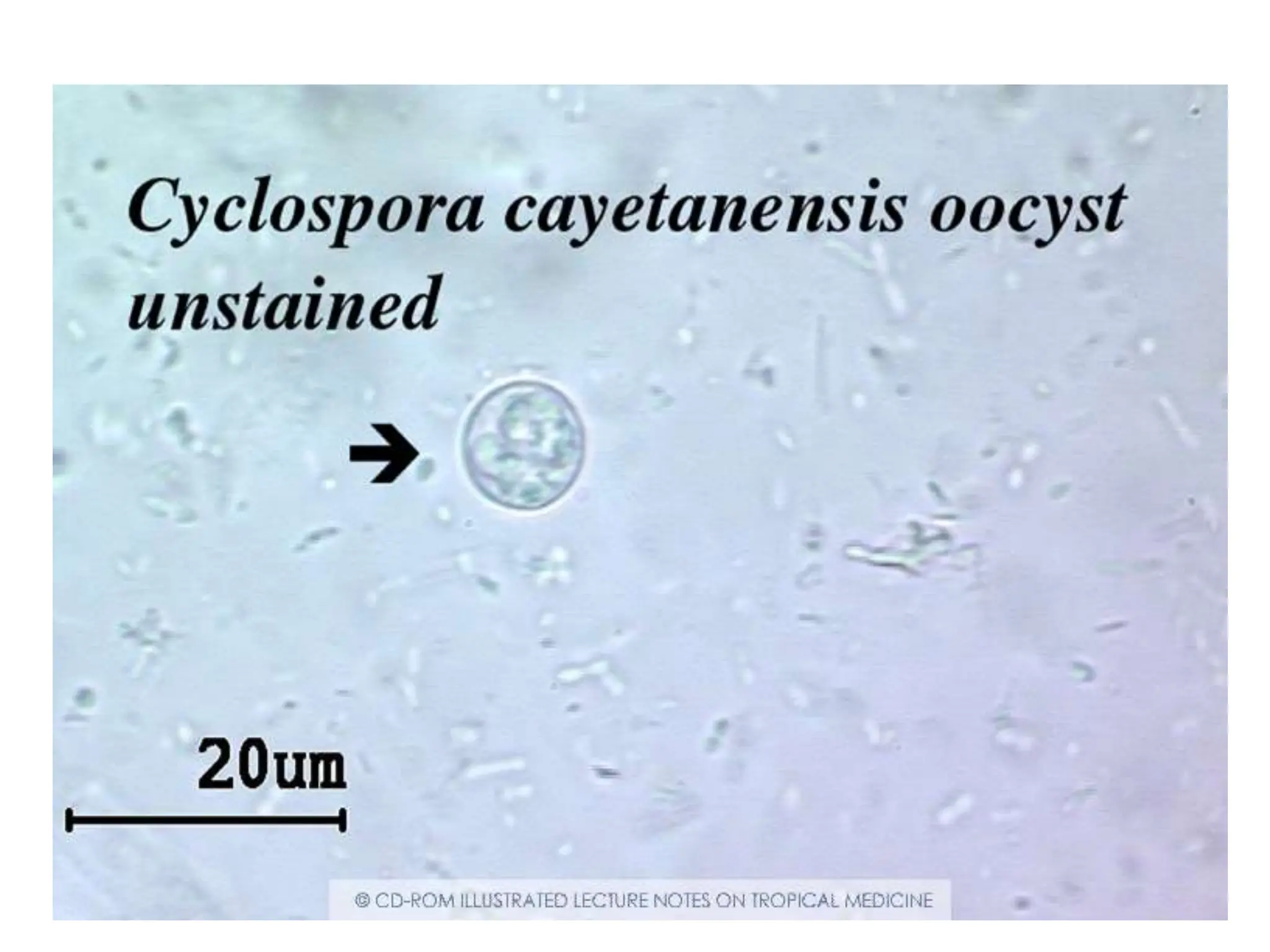 Cyclosporaparasitology medical laboratory technologist .pptx
