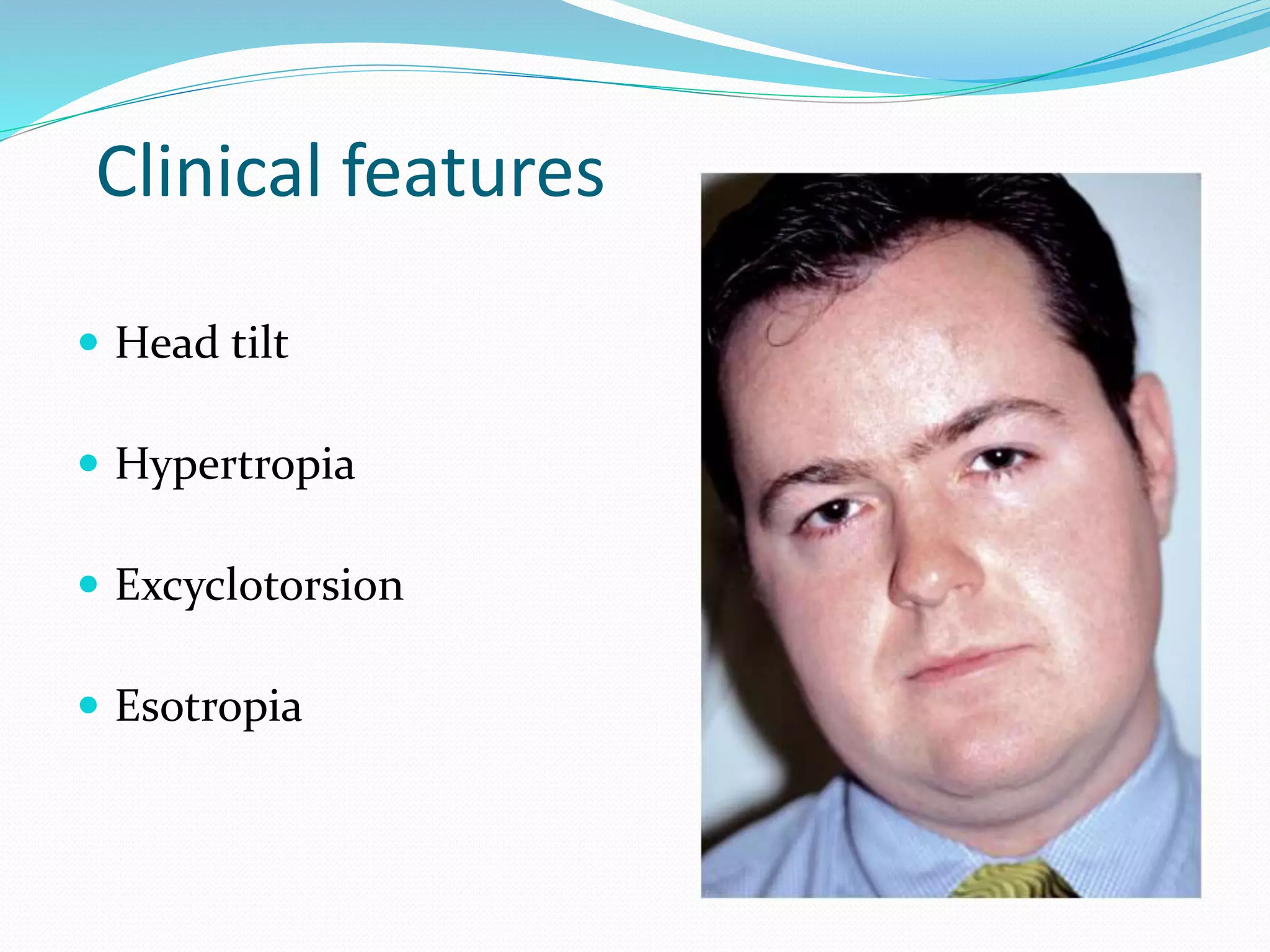 Cyclovertical deviation | PPTX