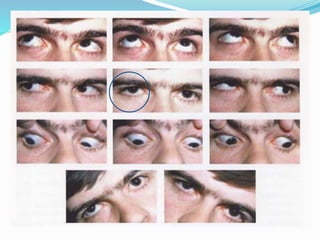 Cyclovertical deviation | PPTX