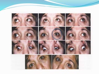 Cyclovertical deviation | PPTX