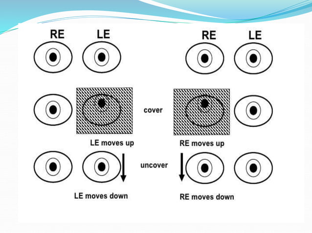 Cyclovertical deviation | PPTX | Eye and Vision Conditions | Diseases ...