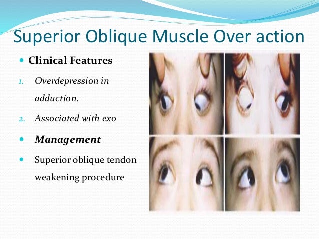 Cyclovertical deviation
