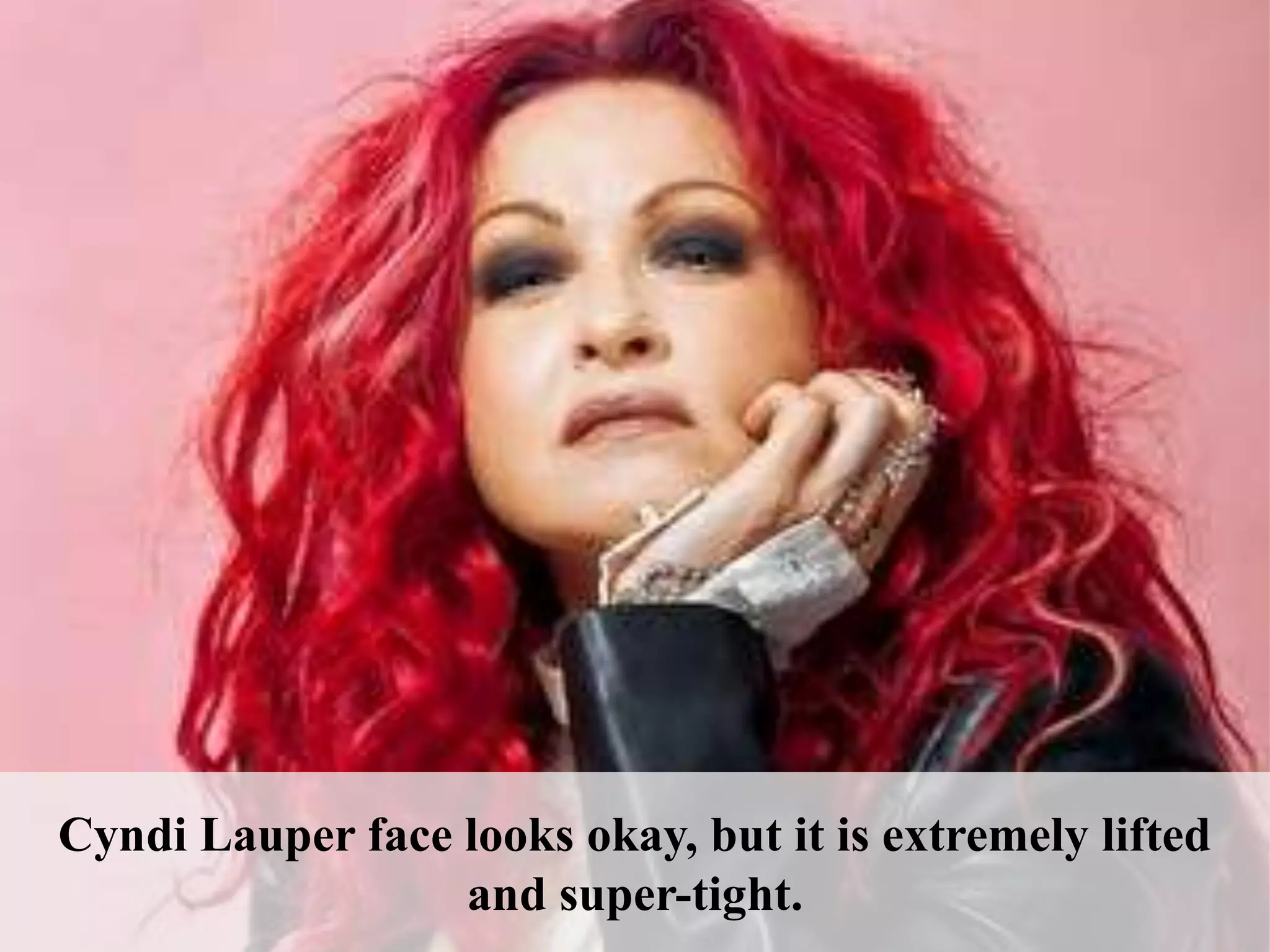 Cyndi lauper plastic surgery | PPTX