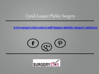 Cyndi lauper plastic surgery | PPTX