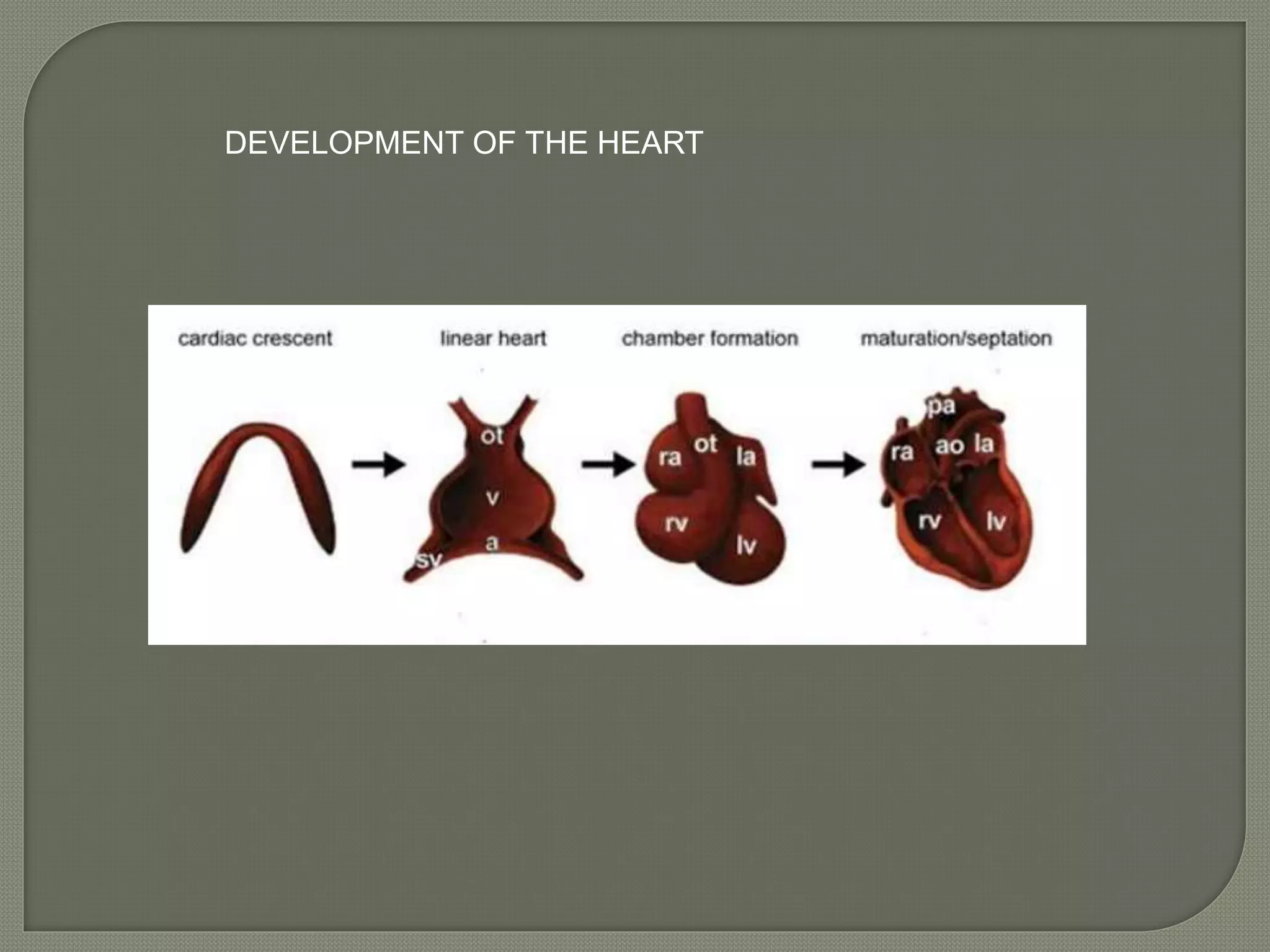 Cynotic heart disease plane radiography | PPT