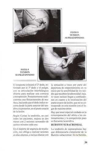 Cyriax masaje-transverso-profundo | PDF